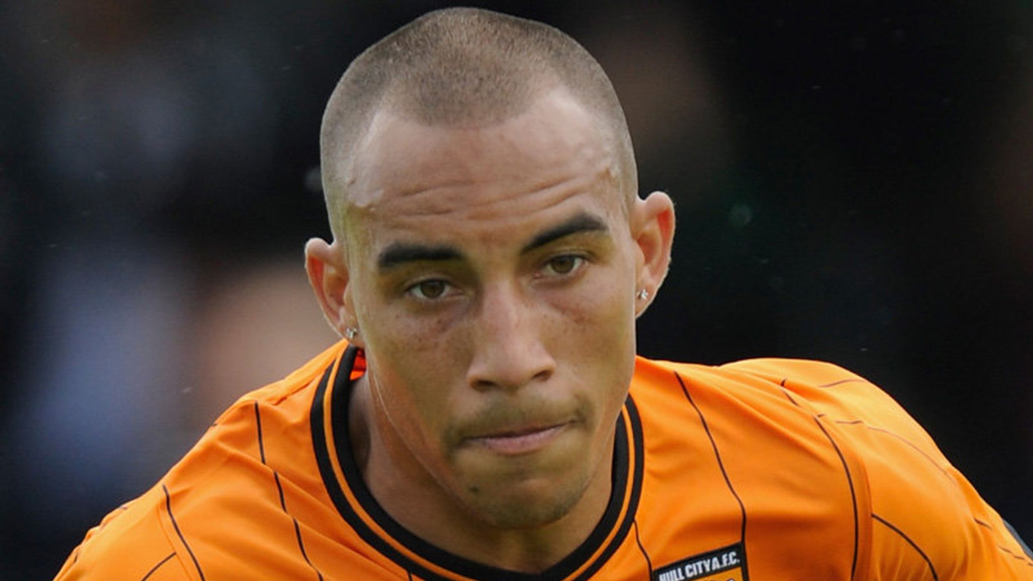 Fagan goes under knife | Football News | Sky Sports