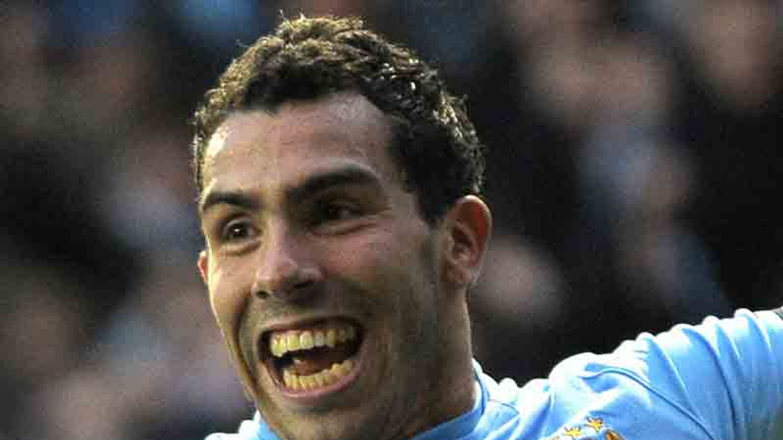 tevez teeth