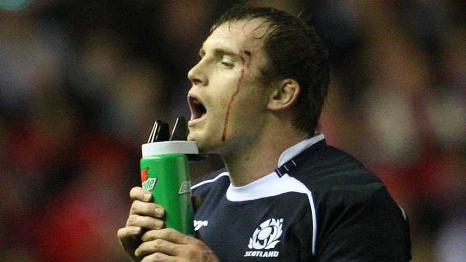 Anxious wait for Scotland | Rugby Union News | Sky Sports