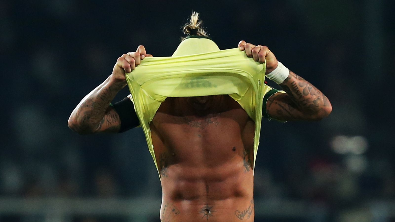 Bizarre footballer injuries: from Steve Morrow to Alessandro Nesta ...