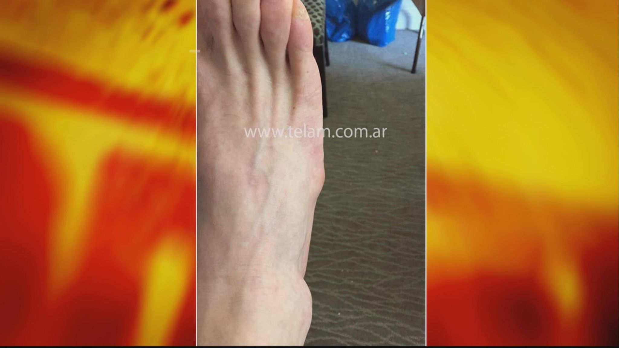 Lionel Messi struggling to shift foot injury, says Guillem Balague ...