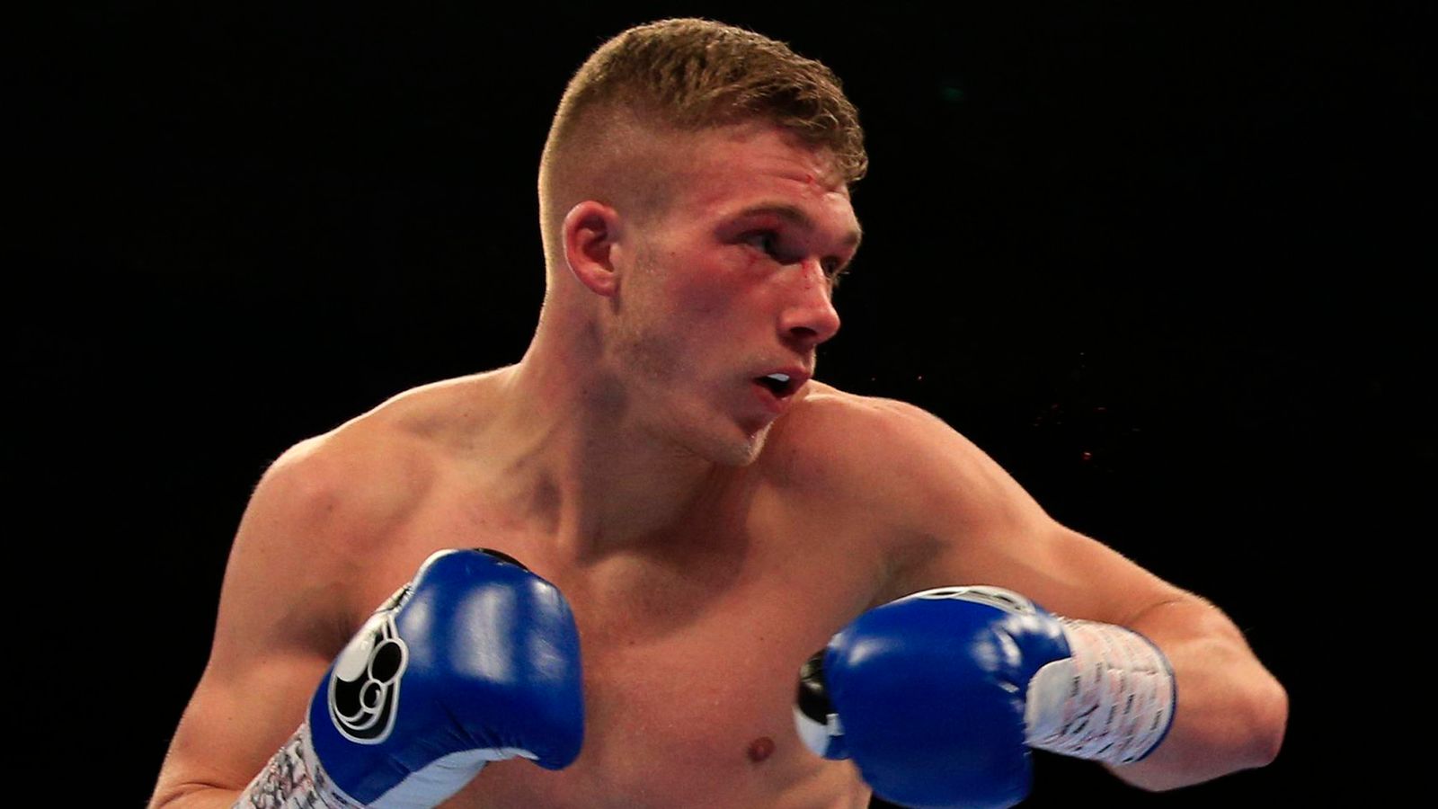 Nick Blackwell says he is 'very lucky' after avoiding serious head ...