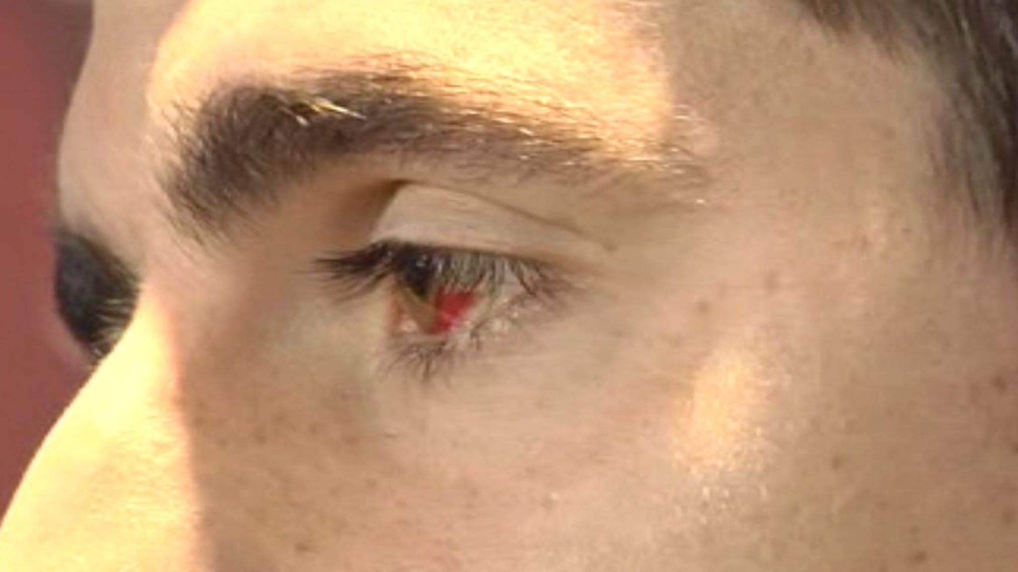 Thibaut Courtois insists 'scary' bloodshot eye is not an issue for ...