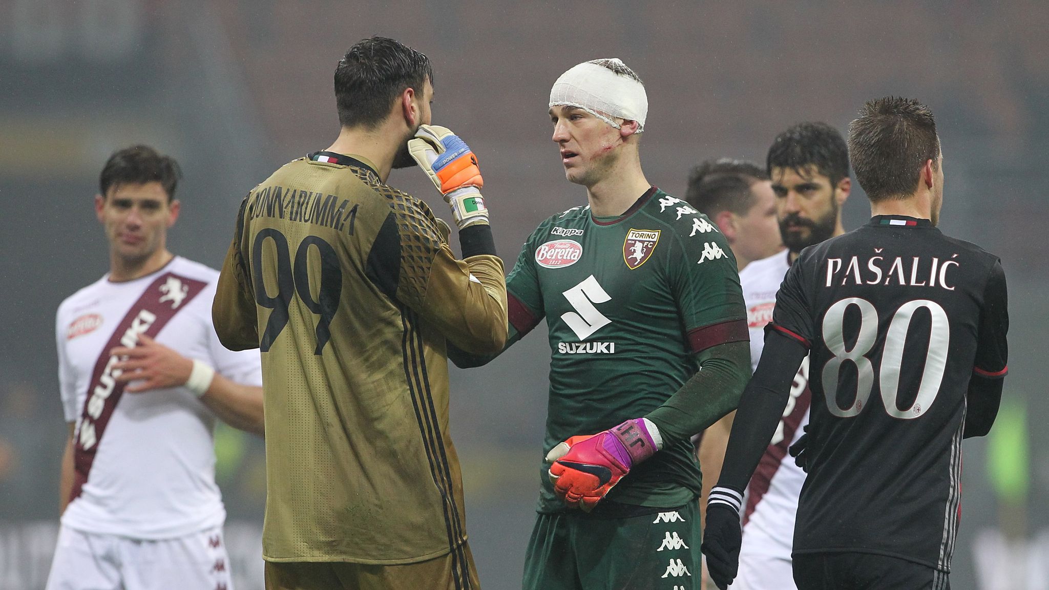 Torino goalkeeper Joe Hart suffers head injury in AC Milan defeat ...