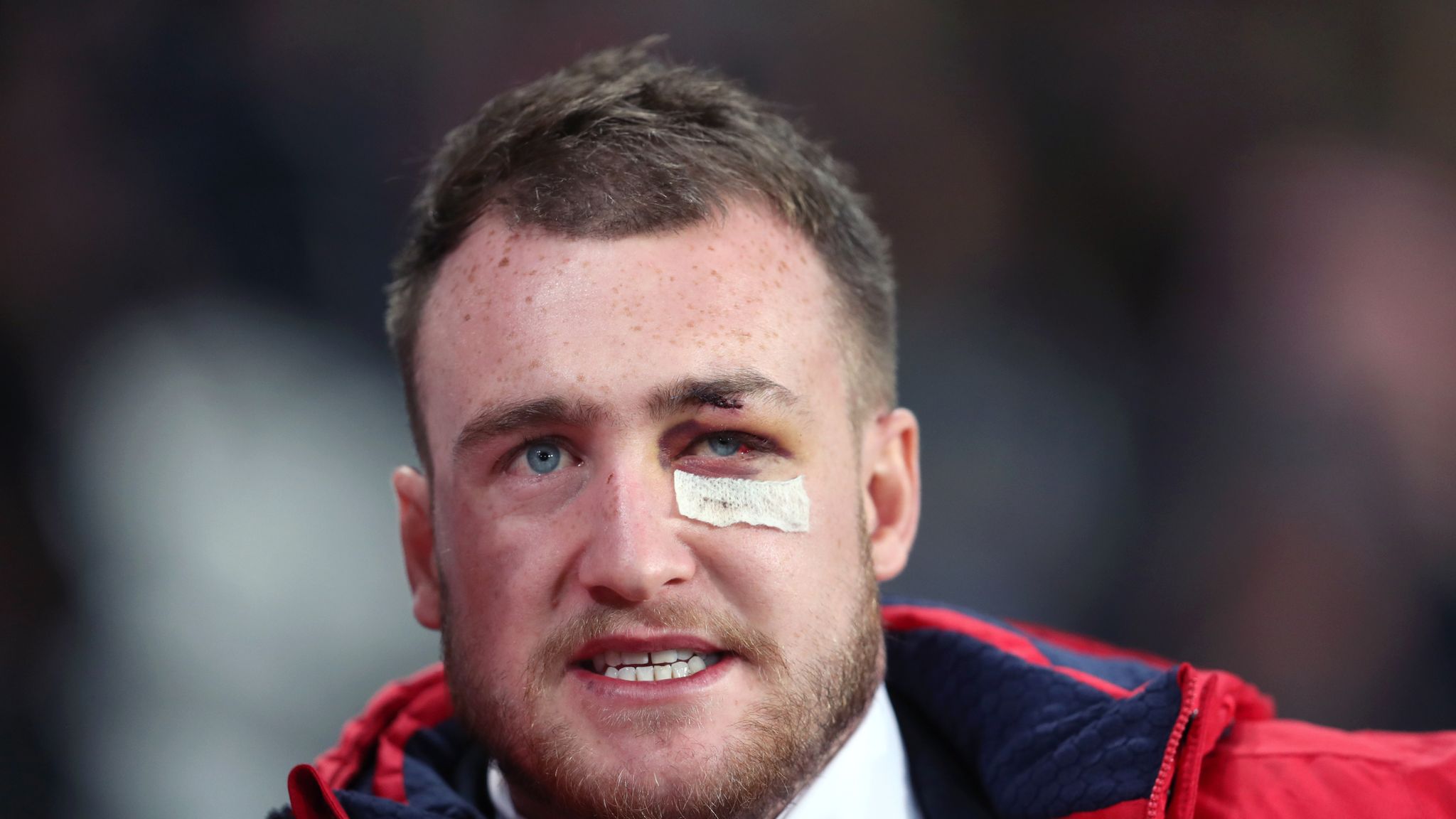 Warren Gatland says Stuart Hogg 'could have been blinded' if he'd ...