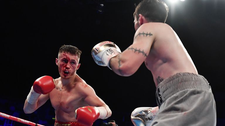 Burnett vs Zhakiyanov: Ryan Burnett will prove his heart and desire ...