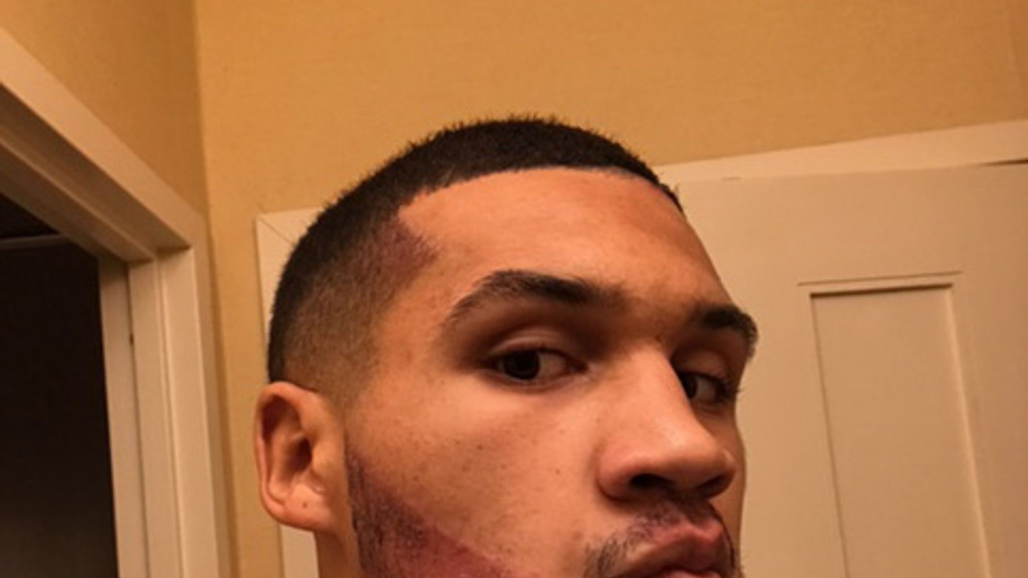 Taylor vs McCaskill: Conor Benn delighted to be fighting at York Hall ...