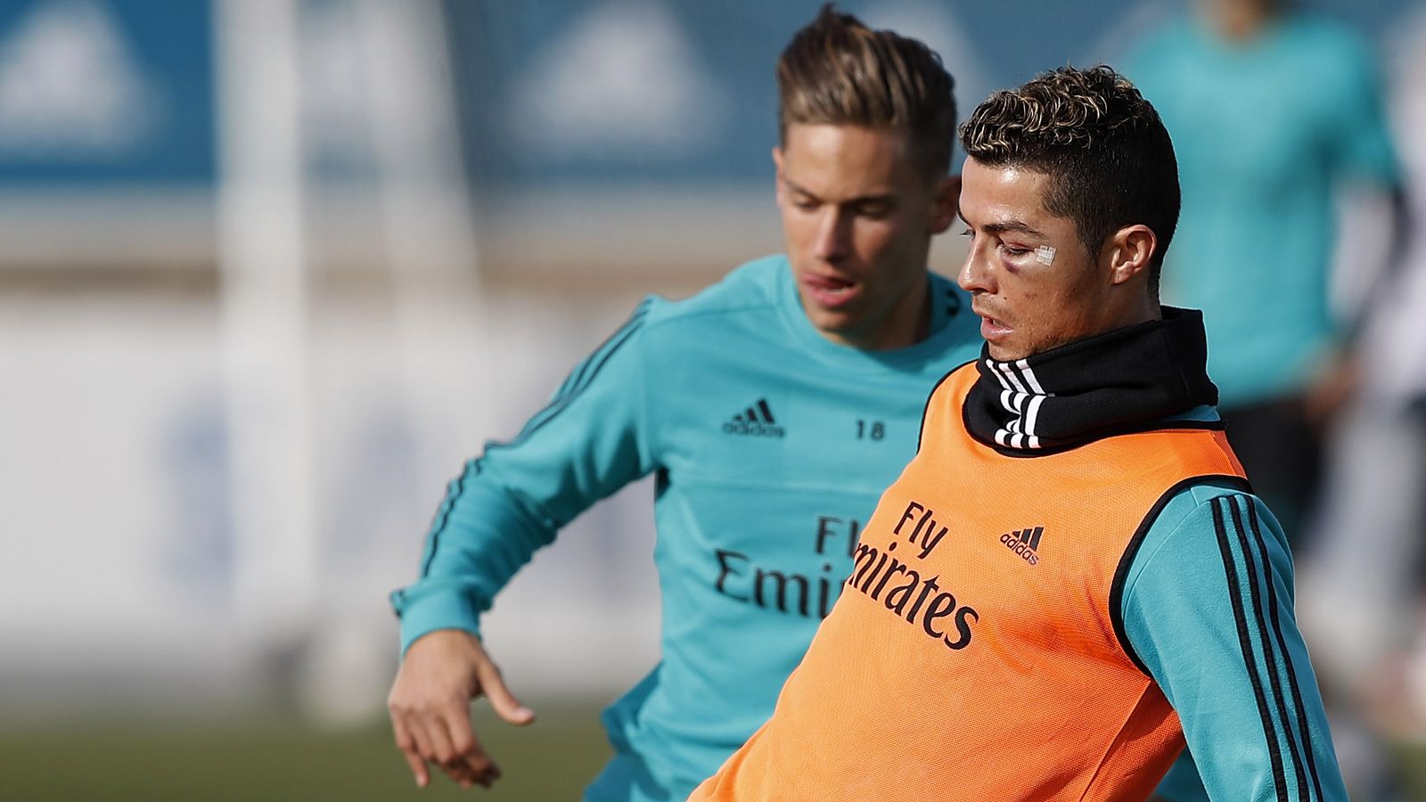 Cristiano Ronaldo trains at Real Madrid with nasty bruise | Football ...