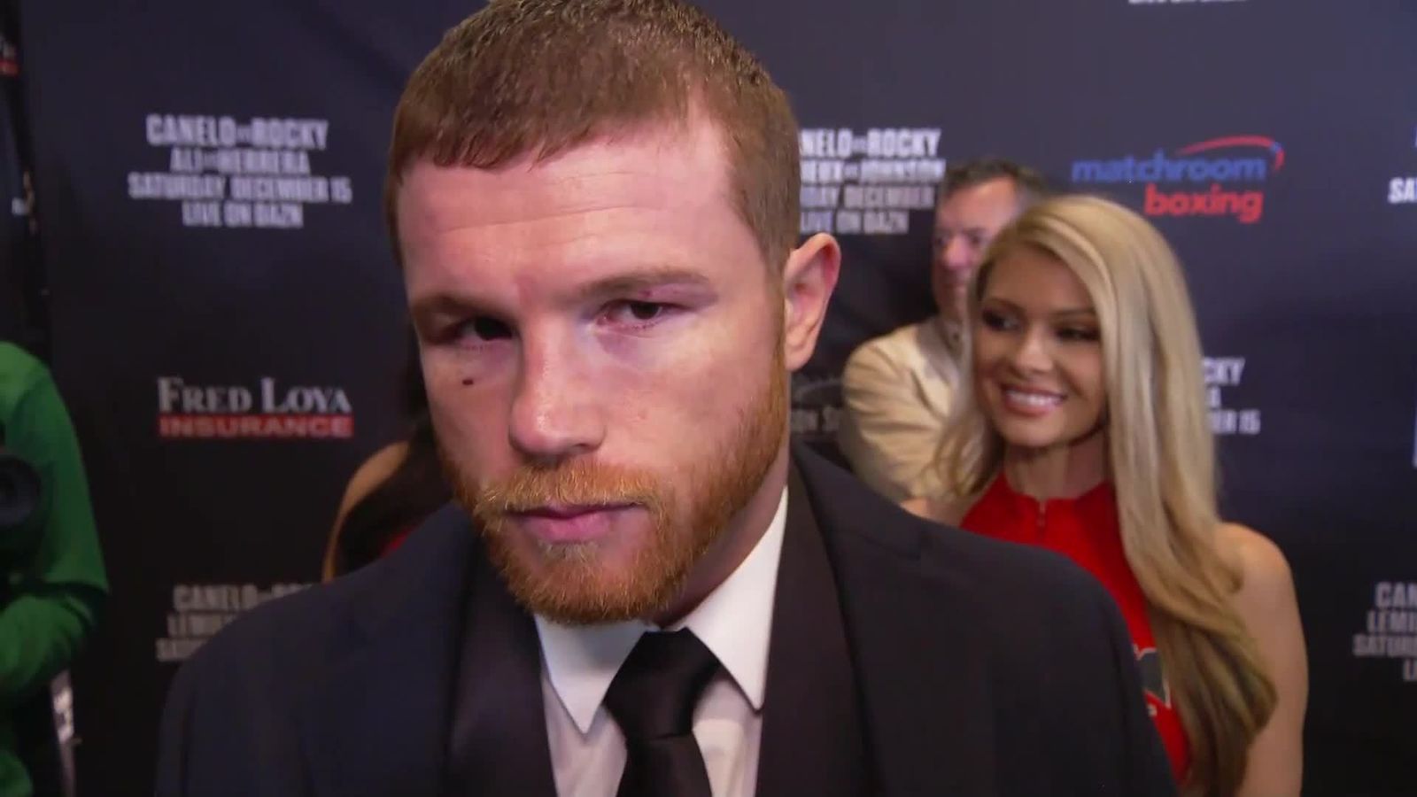 Canelo vs Fielding: Visible mark on Saul 'Canelo' Alvarez's face is not ...