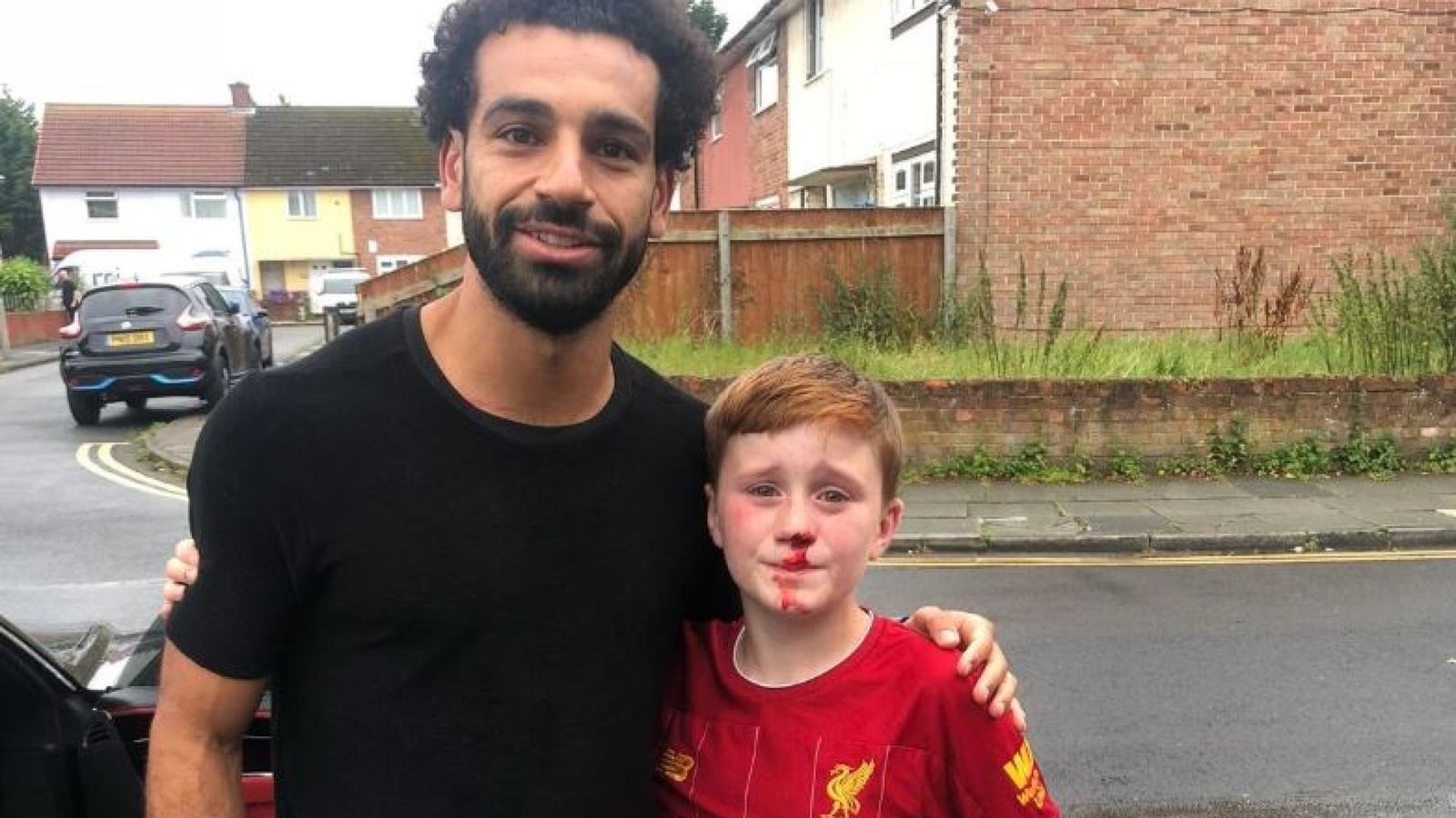 Mohamed Salah poses with boy who broke his nose trying to see Liverpool ... Mohamed Salah poses with boy who broke his nose trying to see Liverpool ...