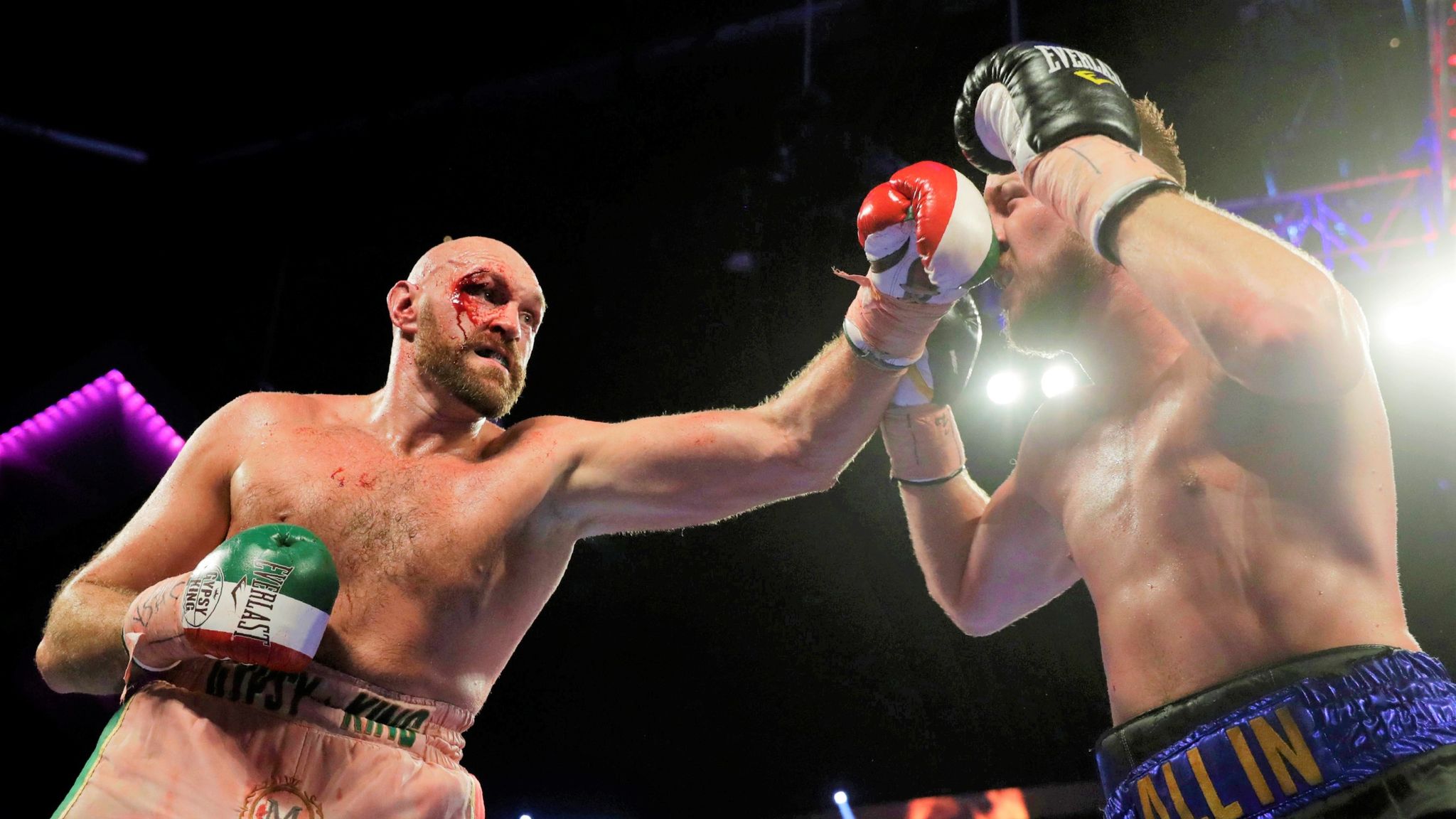 Tyson Fury suffers a cut but bravely does enough to outpoint Otto ...