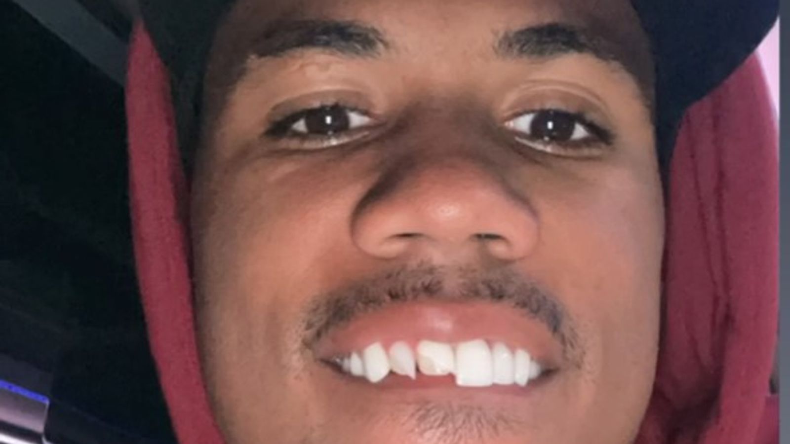 Arsenal's Gabriel has teeth repaired after losing two in draw at ...