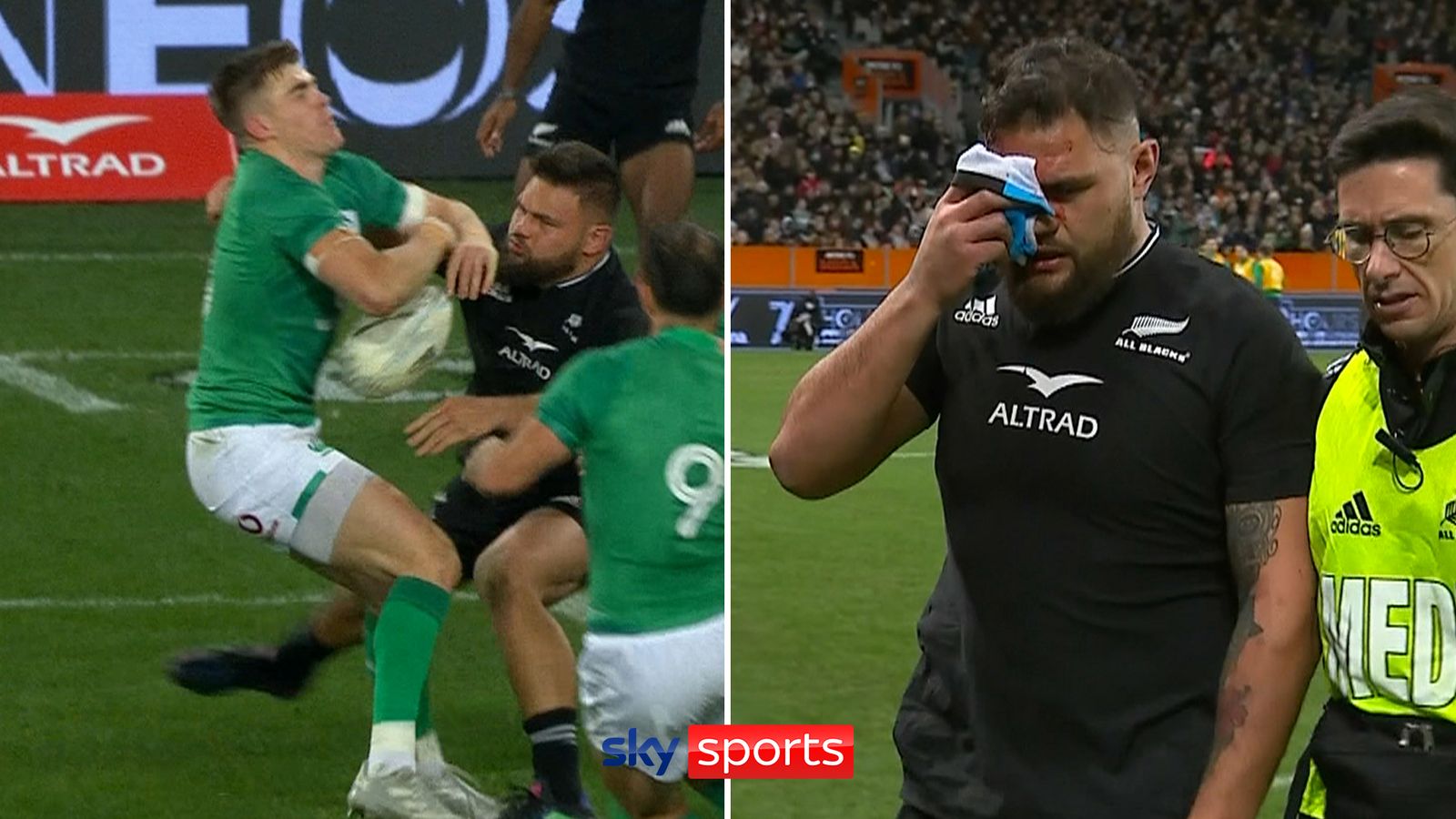New Zealand vs Ireland | Angus Taavao sees red after head clash with ...
