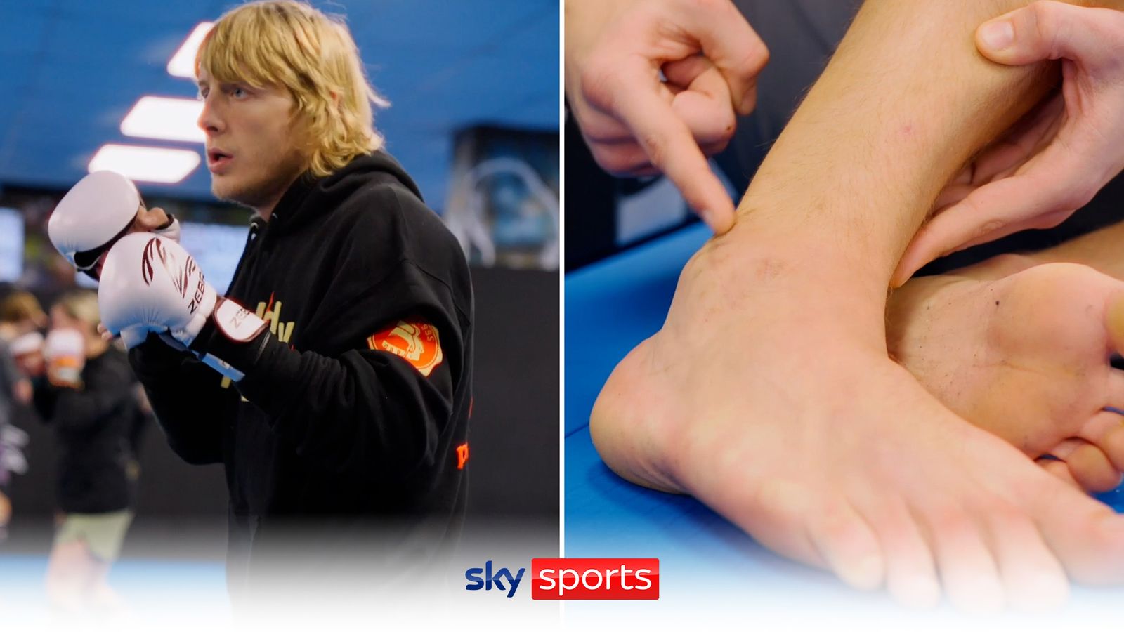 'It hurt mentally' | Paddy Pimblett opens up on injury woes | WWE News ...