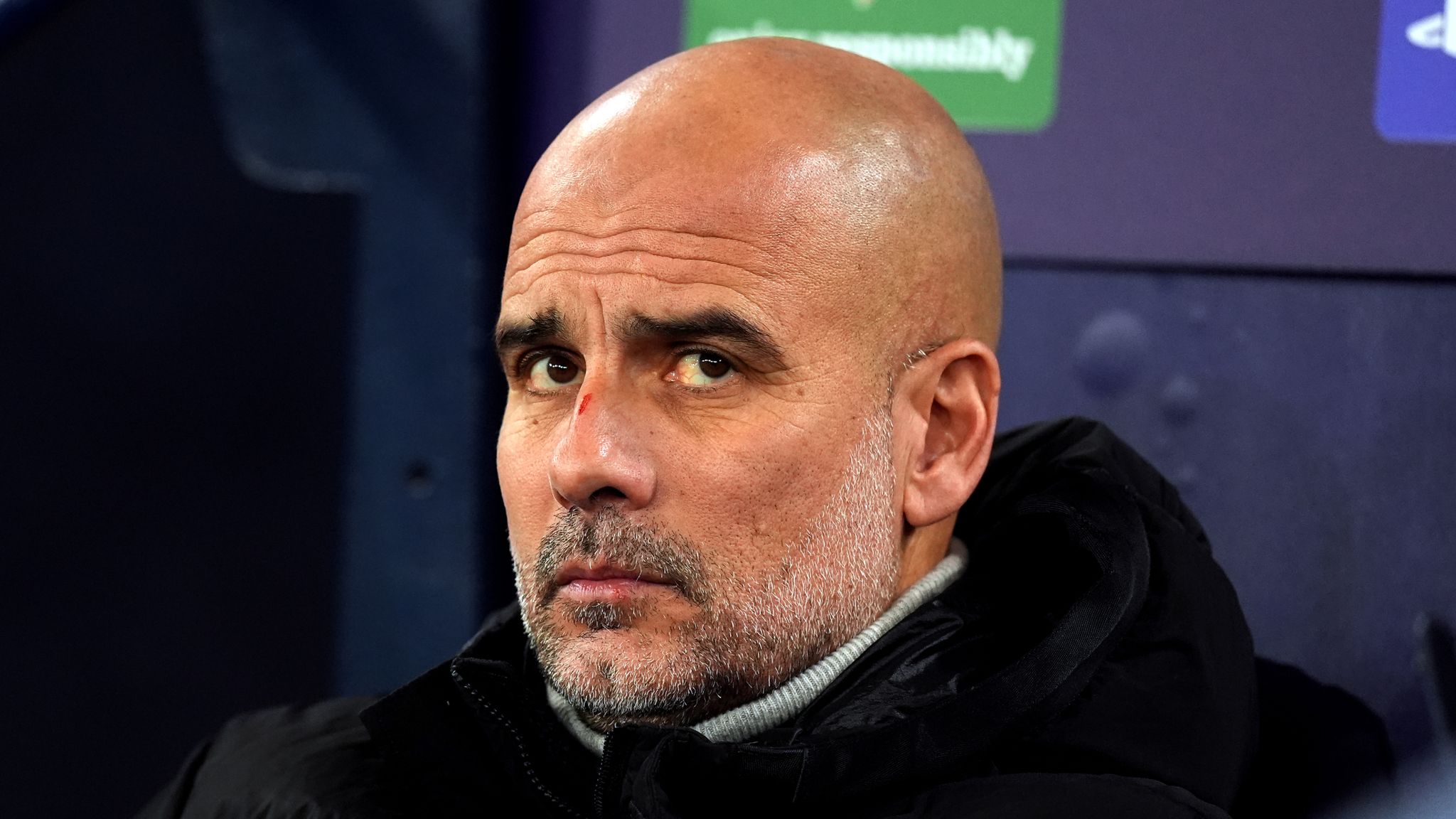 Pep Guardiola: Man City boss clarifies comments about scratches on his ...