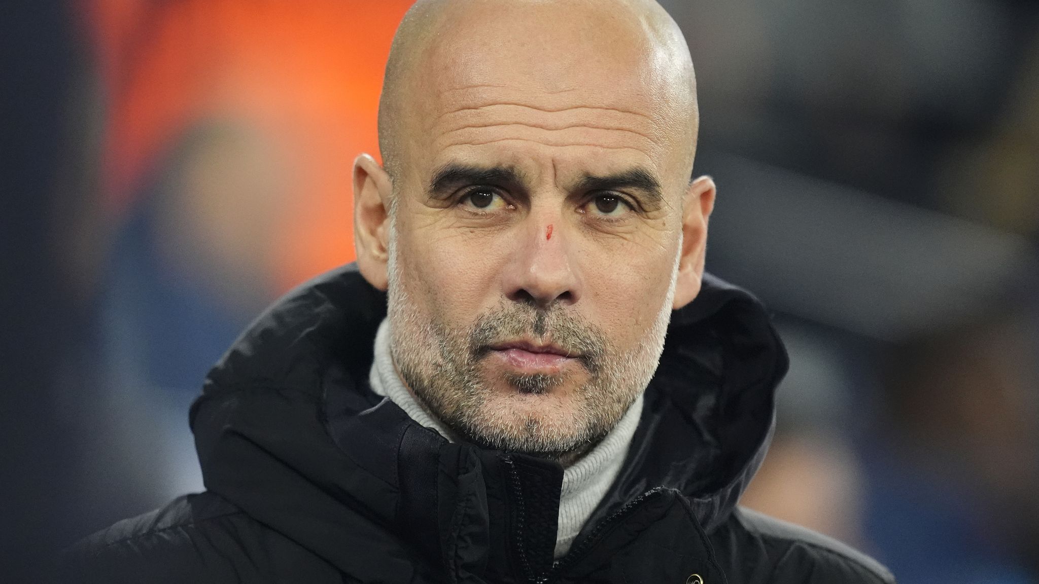 Pep Guardiola: Man City boss clarifies comments about scratches on his ...
