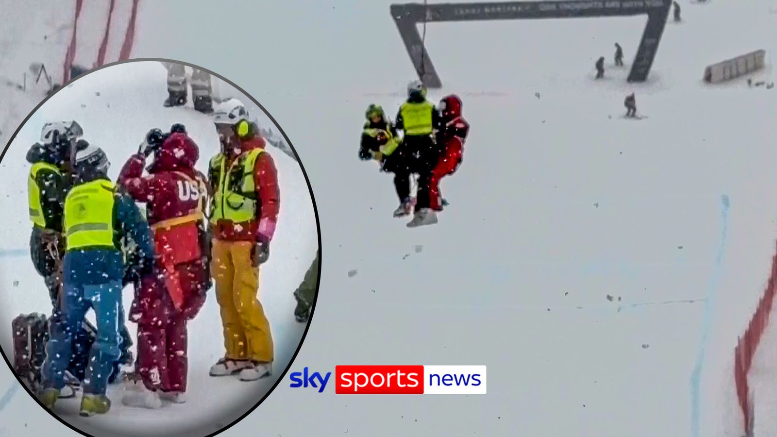 IOC reaffirms decision on Lindsey Vonn after skier has surgery ...