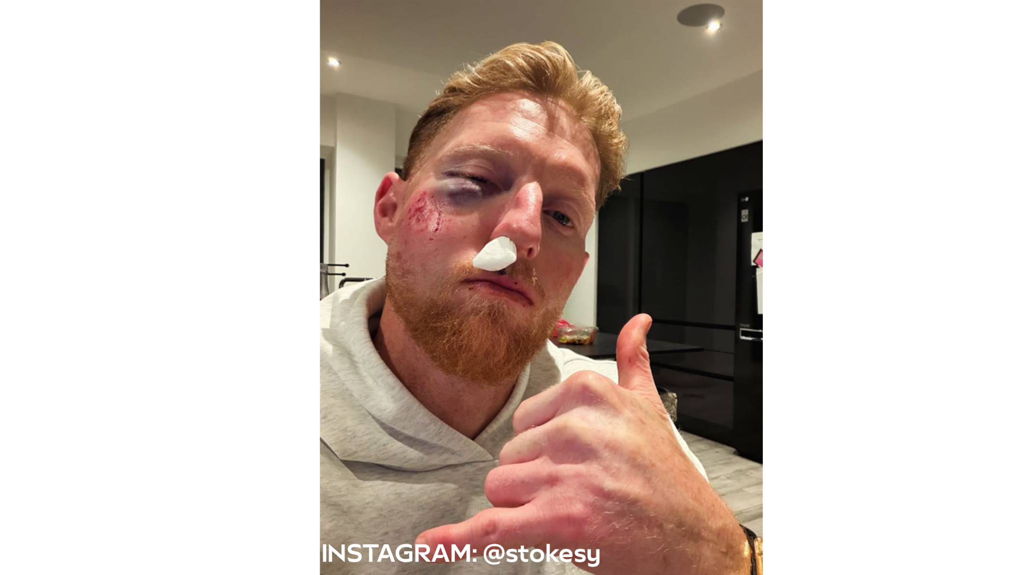 Ben Stokes: England Test captain targets May return after 'lucky ...